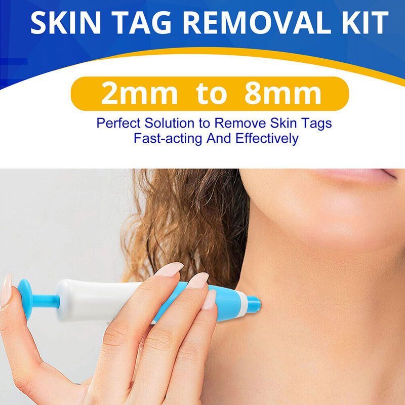 Skin Tag Remover Device Kit – Paktec.nz