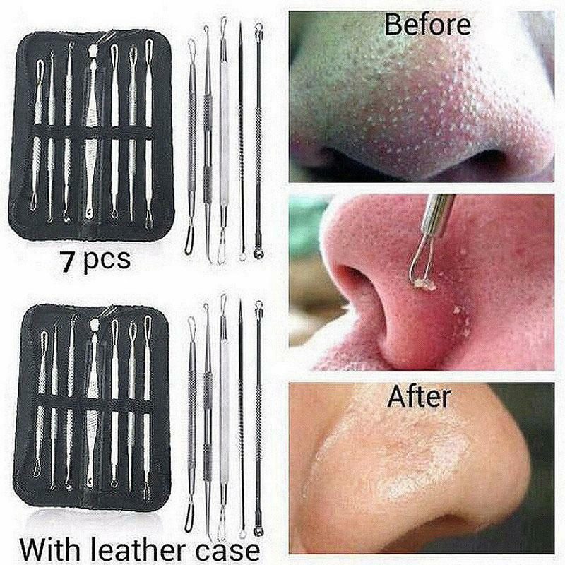 Acne Needle Blackhead Blemish Pimple Extractor Remover – Paktec.nz